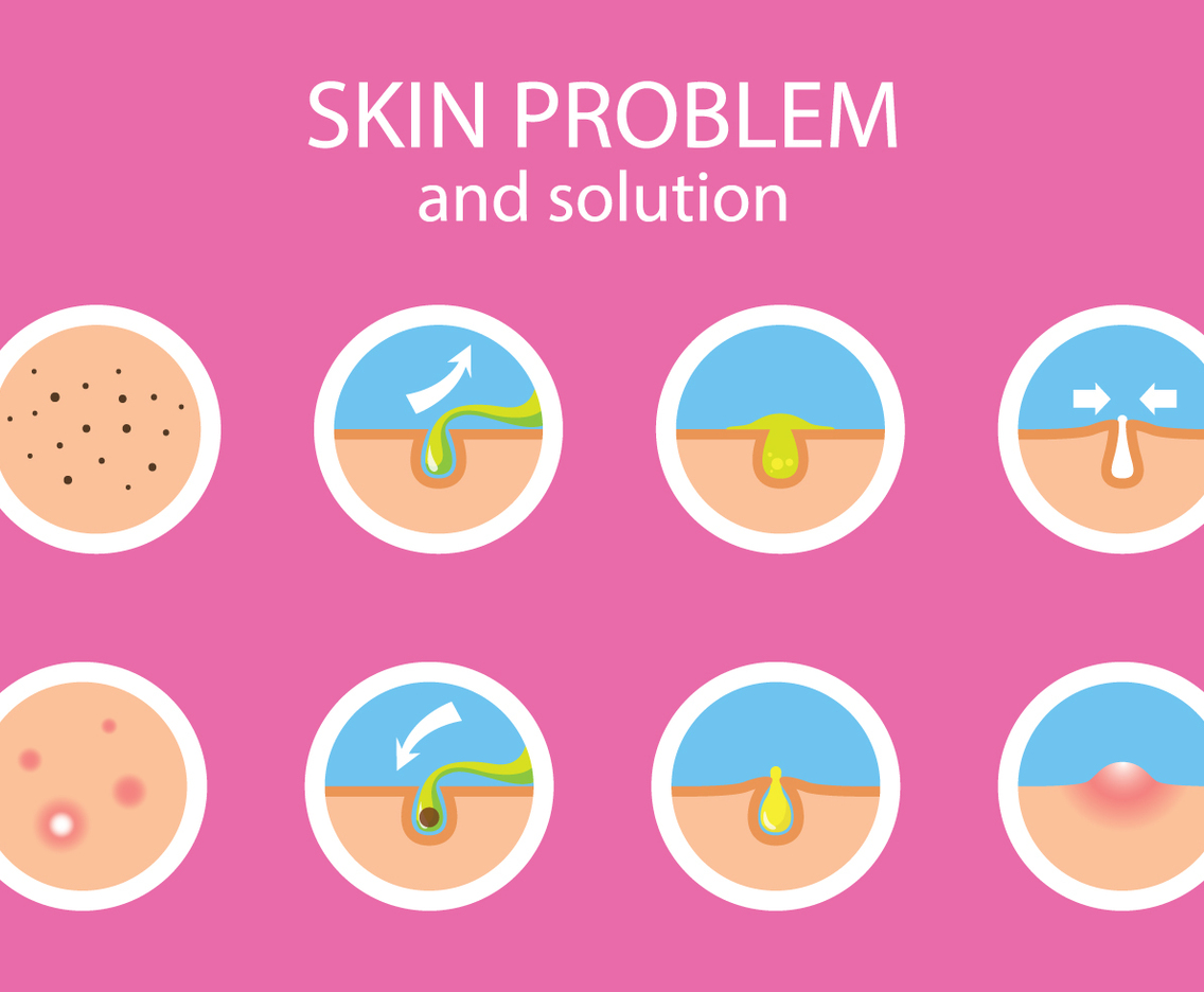 Skin Problems Vector Art & Graphics | freevector.com